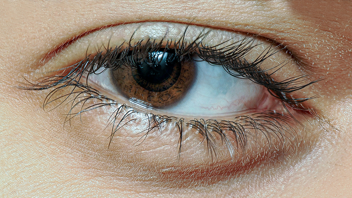 World-first glimpse at cataract genetics | CERA